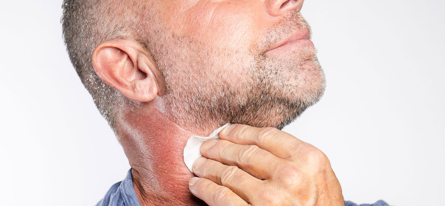 SHAVER'S RASH (FOLLICULITIS) | Queen Bee Salon & Spa